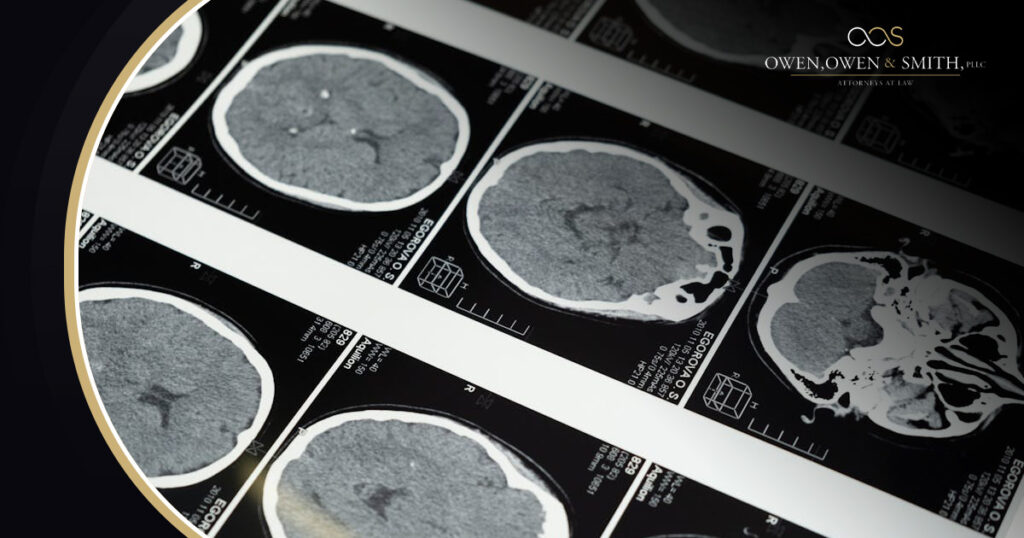 What Brain Injuries Can Occur from a Lack of Oxygen? - Owen, Owen ...